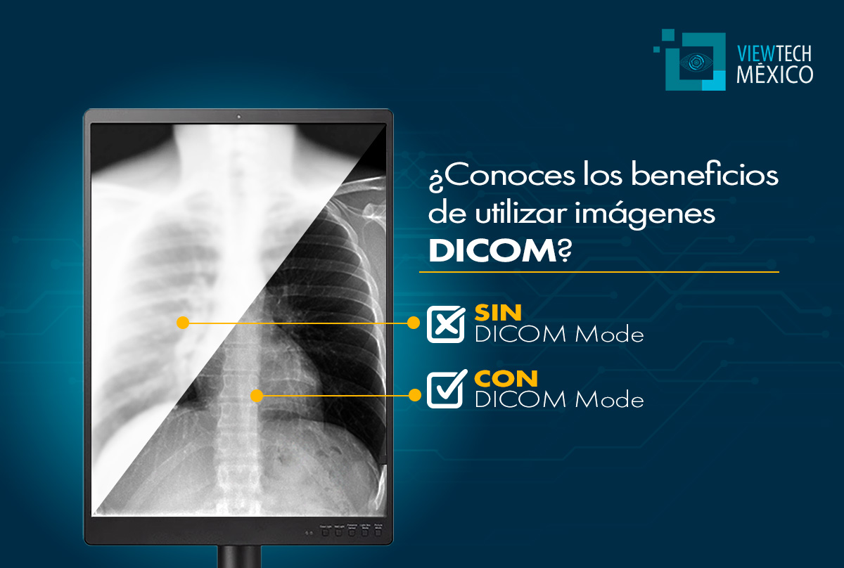 Beneficios de utilizar imágenes DICOM